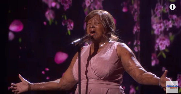 Ray Marcano Archives - Rare