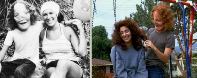 The Real-Life 'Mask' Family — Before Cher and Eric Stoltz